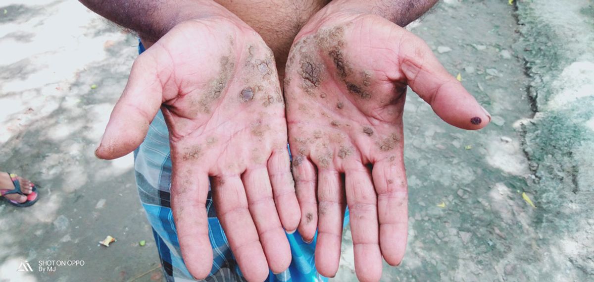 West Bengal’s Gaighata: Where arsenic toxicity in livestock is now ...